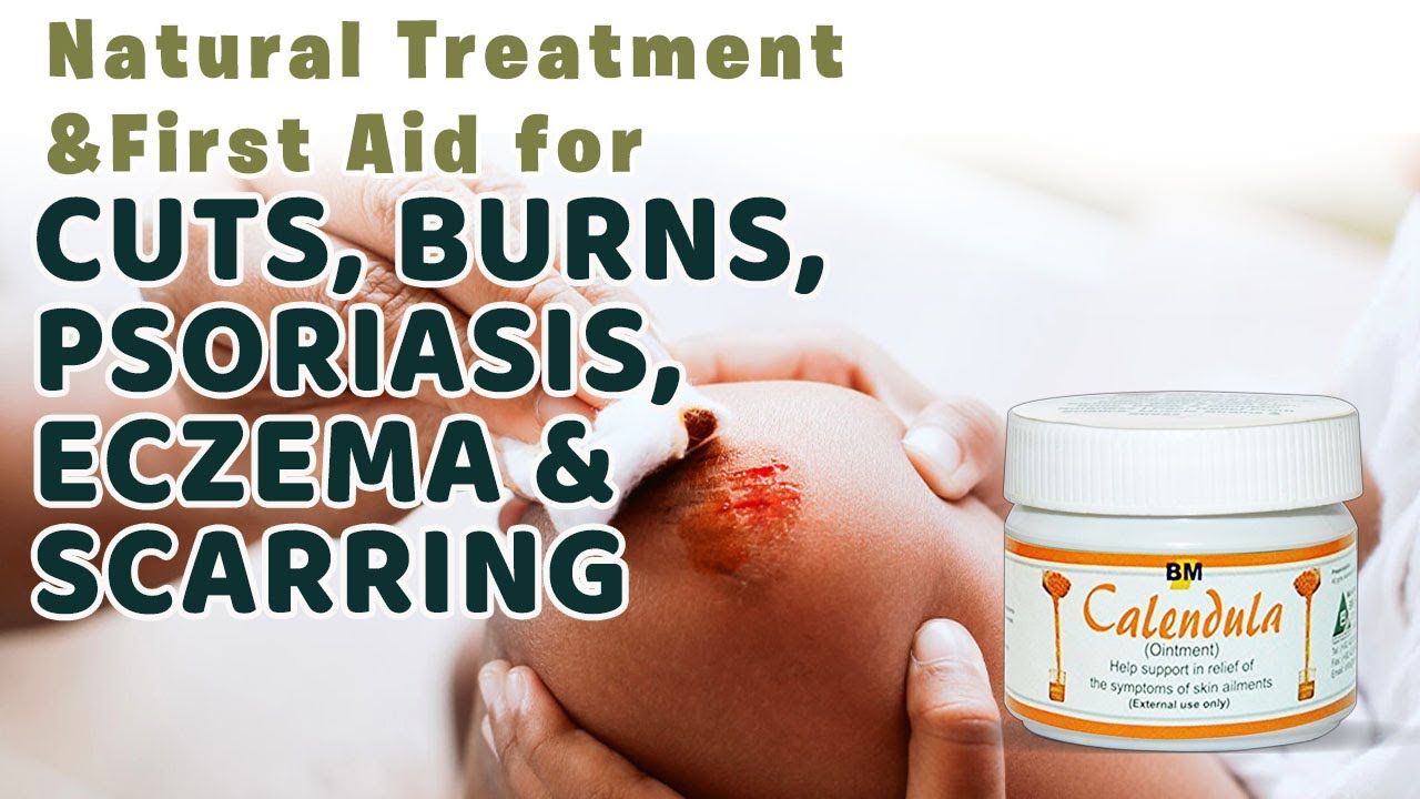 Calendula Ointment a Natural Treatment and First Aid for Cuts, Burns ...