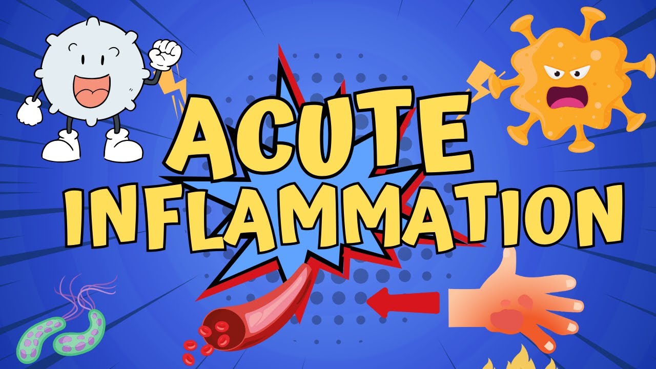 Acute Inflammation Pathophysiology And Cell Response - YouTube