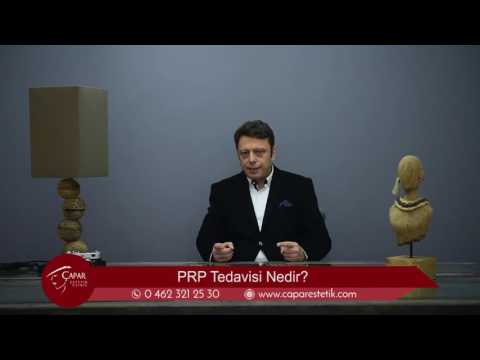 PRP Tedavisi Nedir