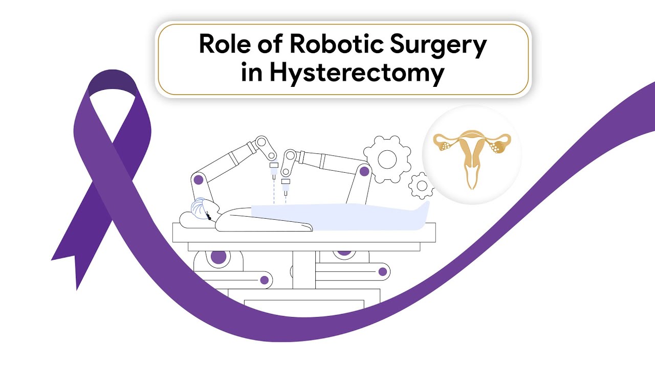 Robotic Surgery for Cervical Cancer & Hysterectomy | FAQs with Dr ...