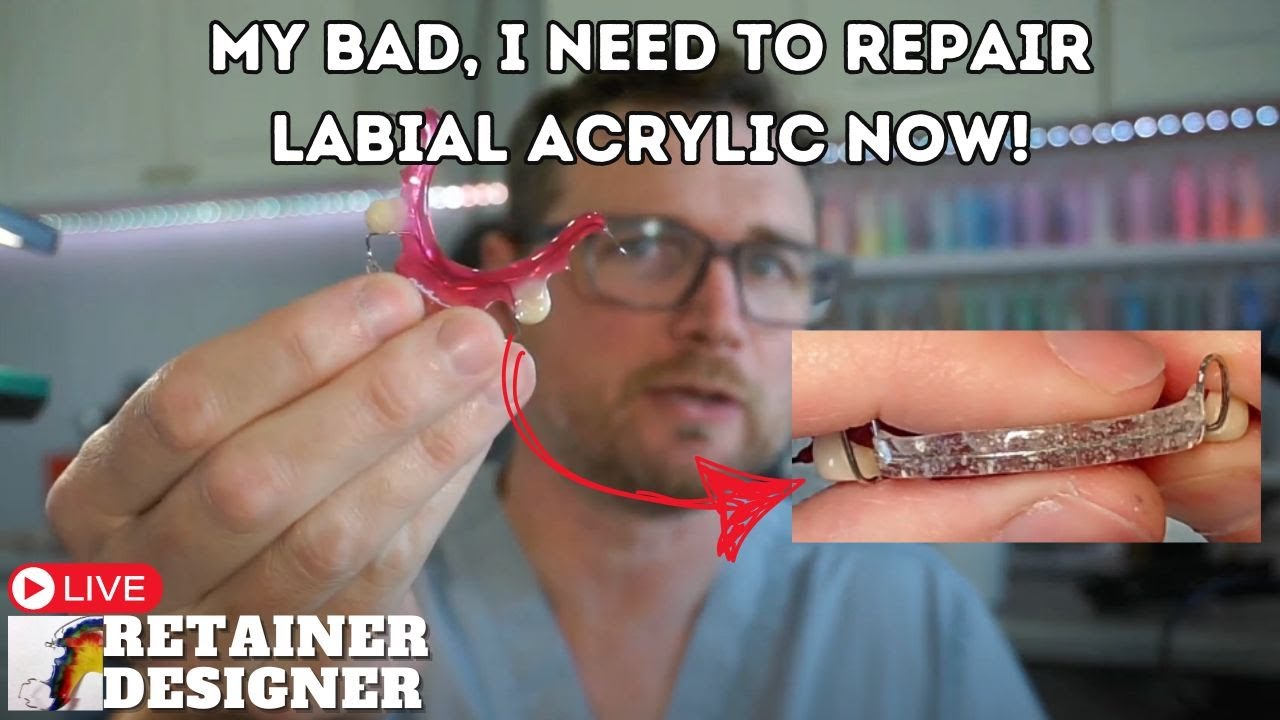 How to Repair Labial Acrylic - YouTube