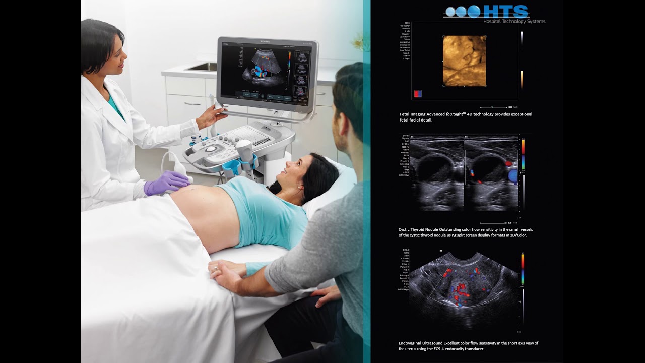 Video acuson nx2 ultrasound marzo 2019 AM - YouTube