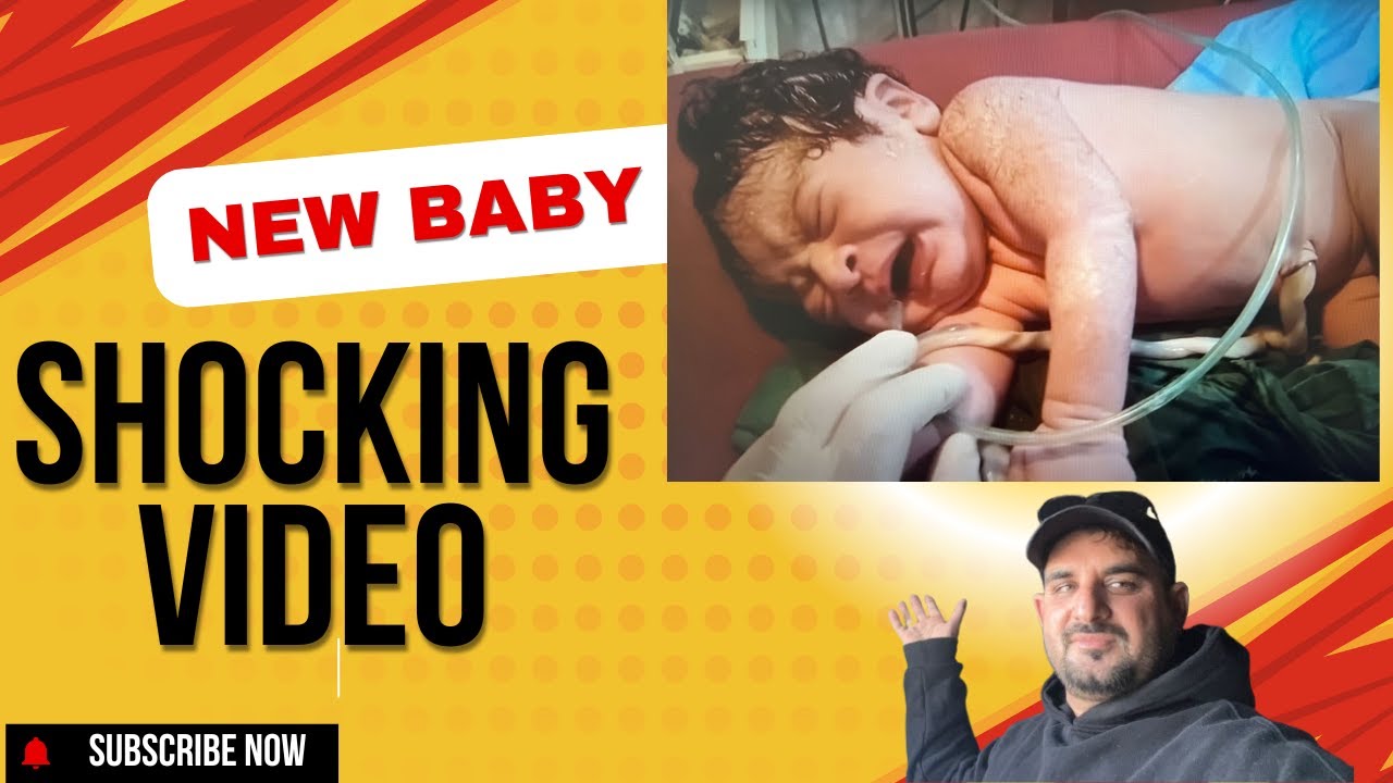 New burn baby without breathing Shocking video - YouTube