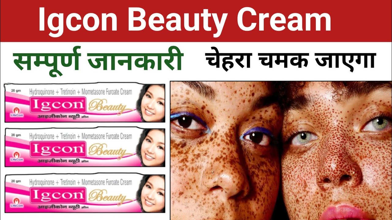 igcon beauty cream || igcon beauty cream ke fayde in hindi || igcon ...