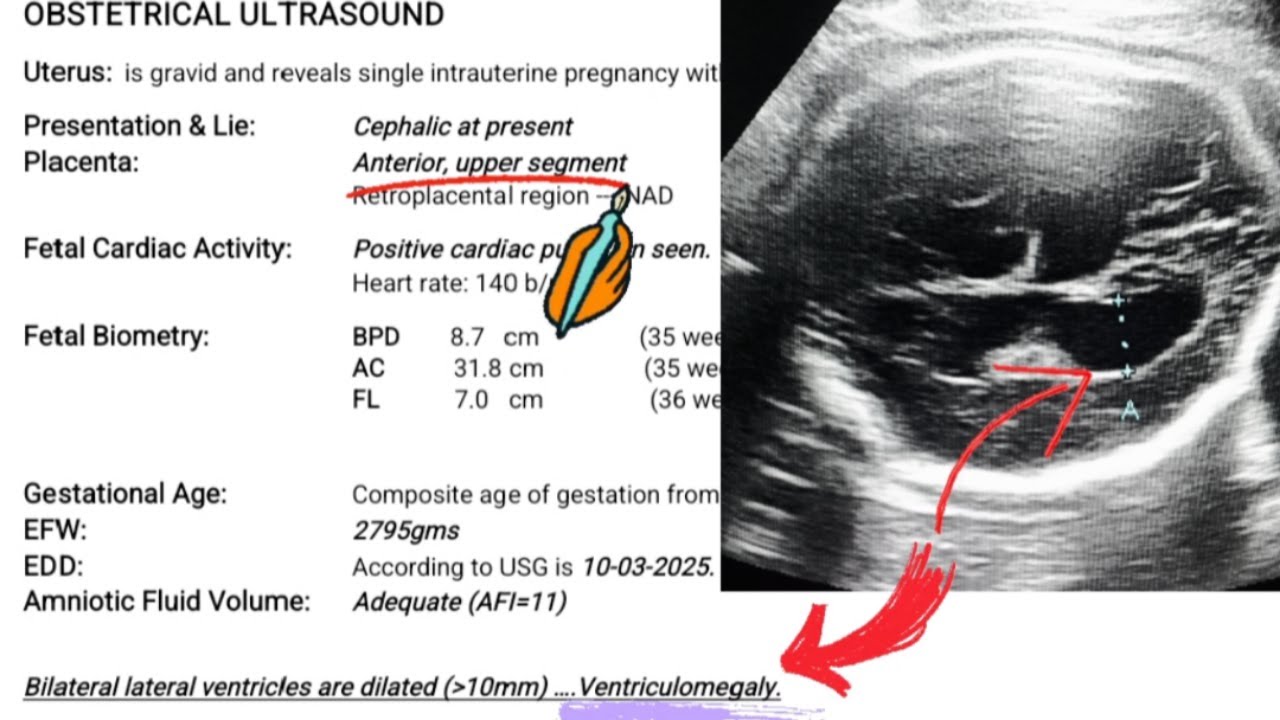 Pregnancy Scan Report At 35 Weeks 5 Days | Baby Boy | Fetal ...