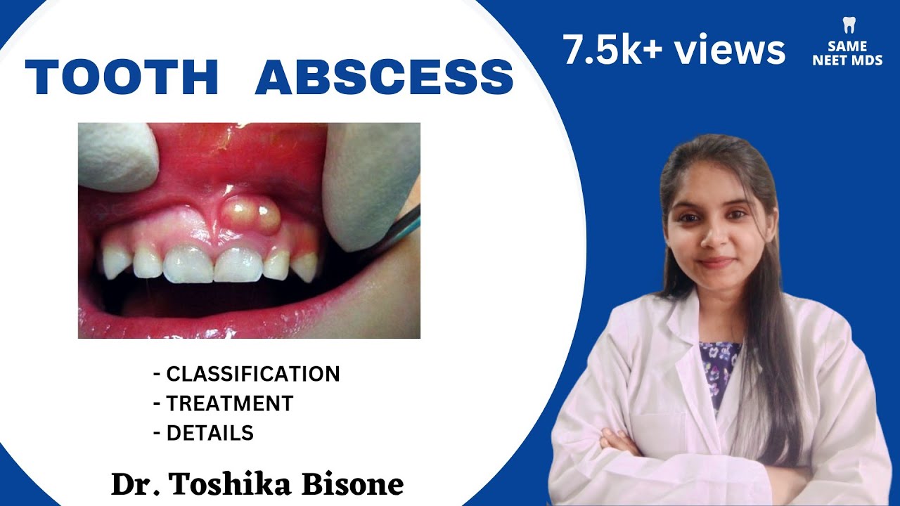 Abscess | Classification | treatment | details | with notes | general ...