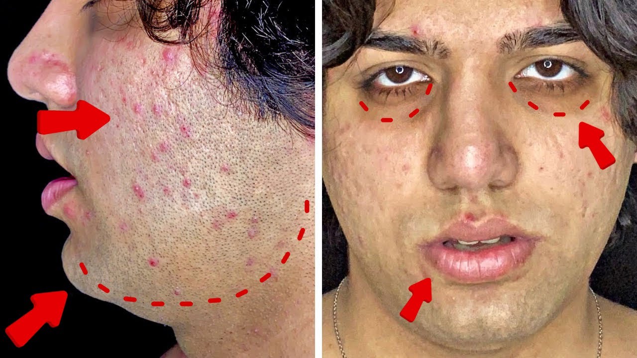 MOST UNATTRACTIVE FEATURES that makes you LOOK UGLY | (How to Fix ...