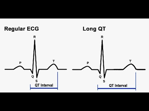QT Interval Prolongation, inherited Long QT Syndrome; Definition ...
