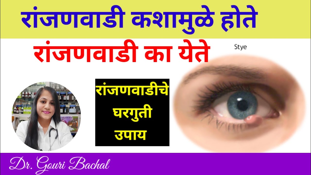 रांजणवाडी कशामुळे होते /रांजणवाडी येण्याची कारणे /रांजणवाडी का येते ...