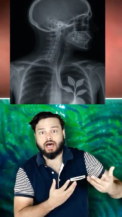 Plant INSIDE Lungs! Very RARE Medical CASE #shorts - YouTube