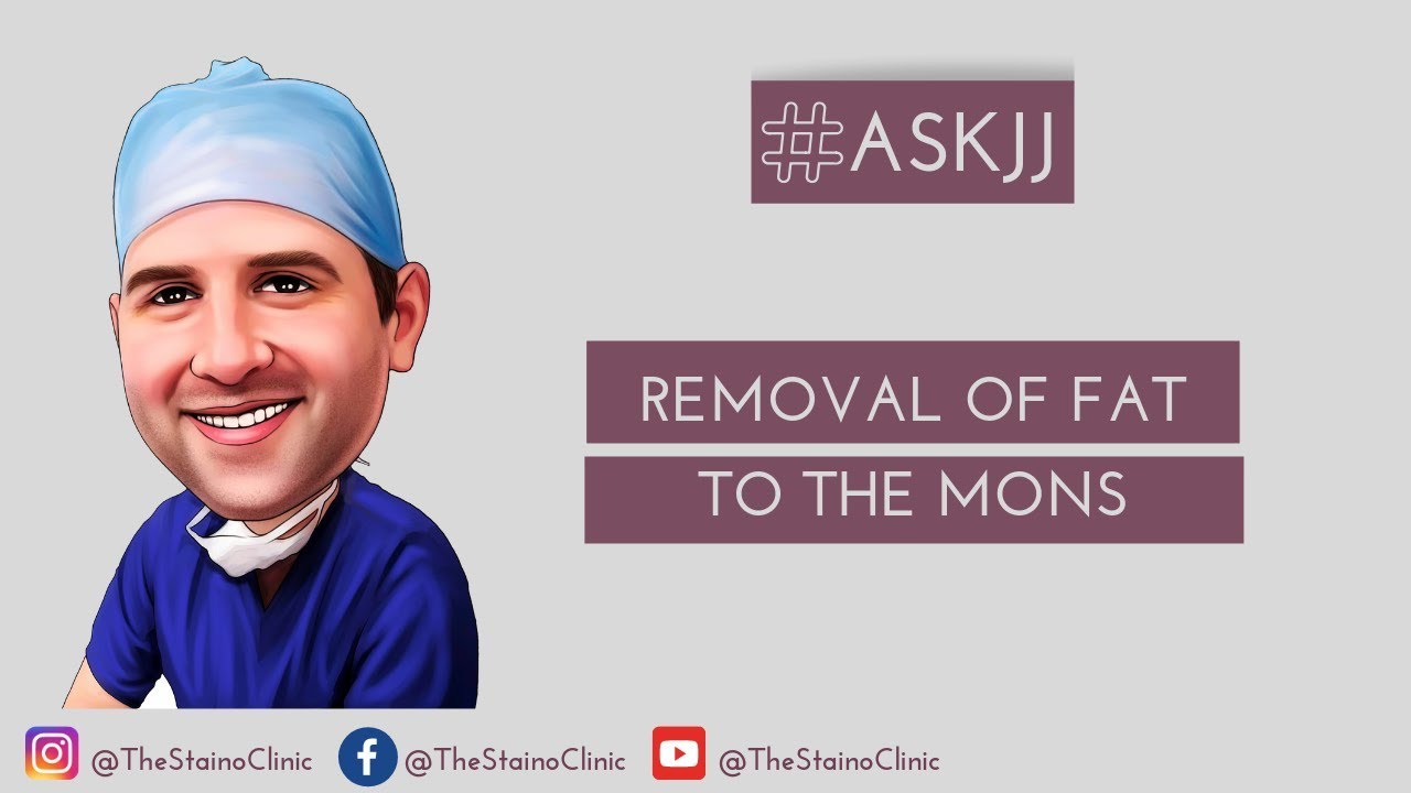 Removal of fat to the mons - YouTube