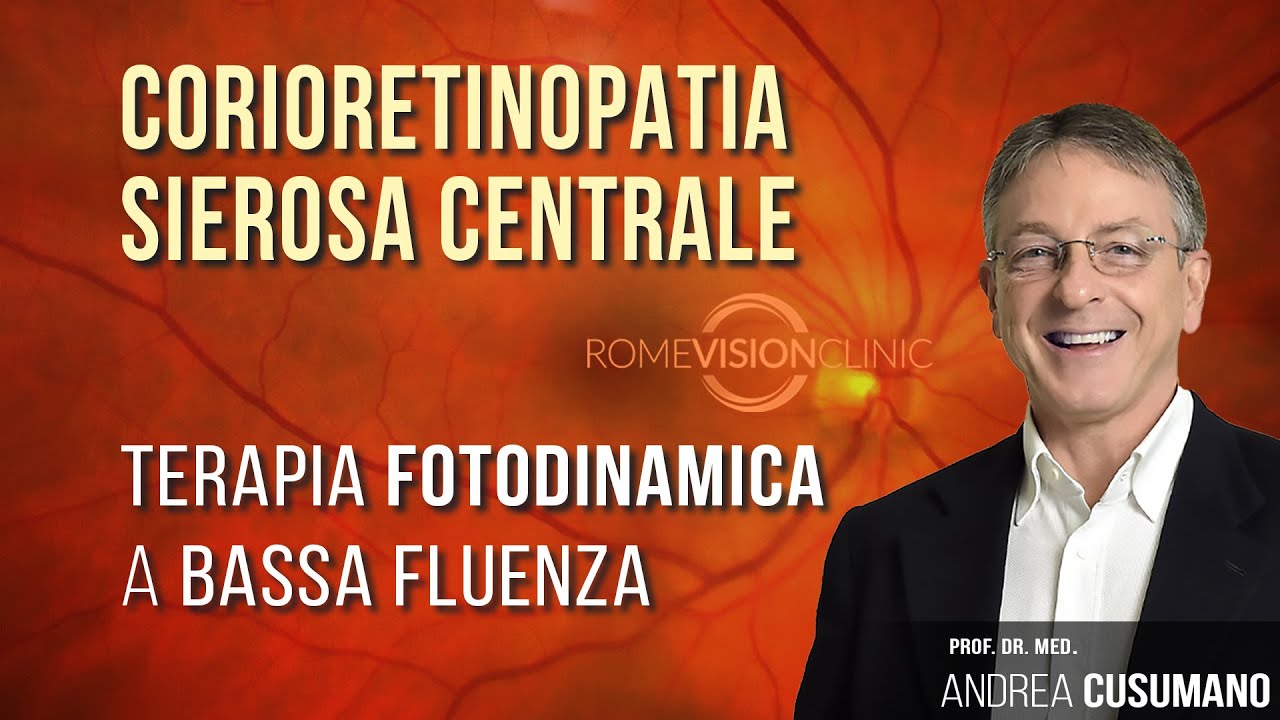 Corioretinopatia sierosa centrale (CSCR) e terapia fotodinamica a bassa ...