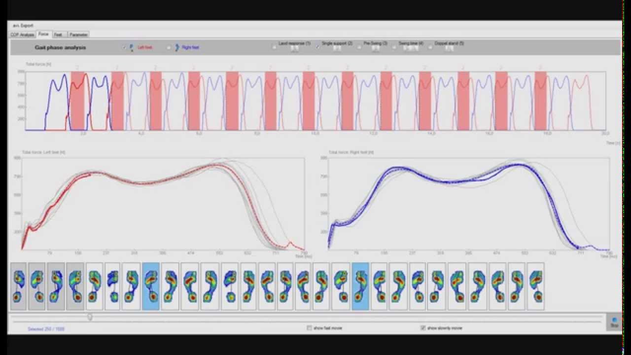DIERS pedogait - Foot & Gait Analysis - YouTube