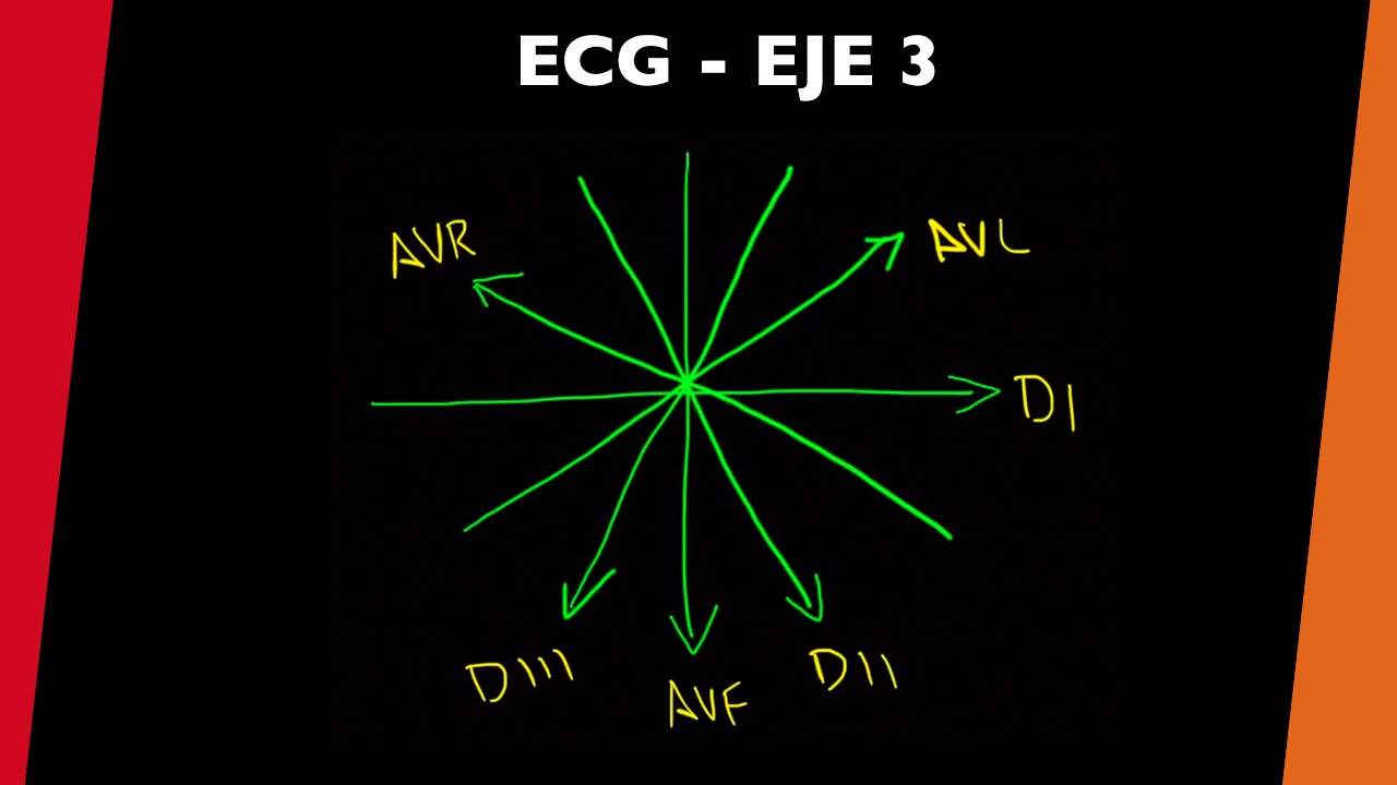ECG - Eje 3 - [visita mi Podcast y aprende Medicina mientras descansas ...