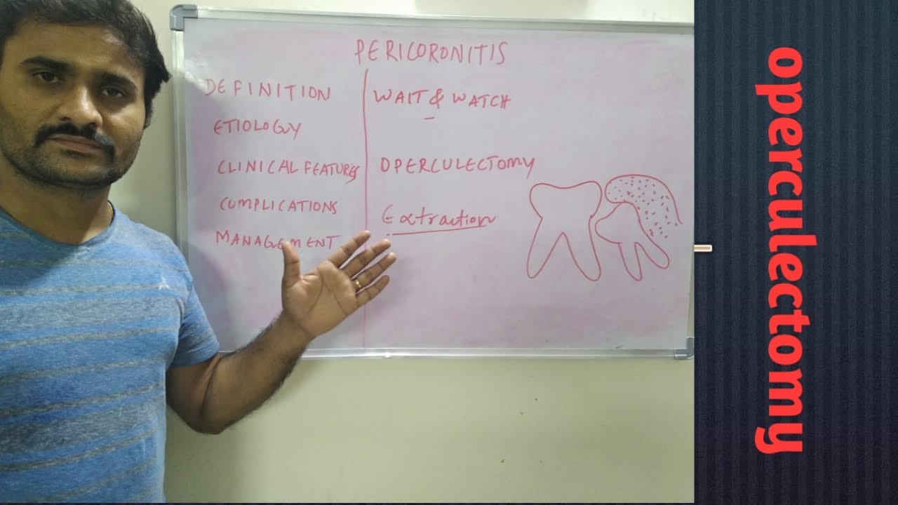 pericoronitis/operculectomy - YouTube