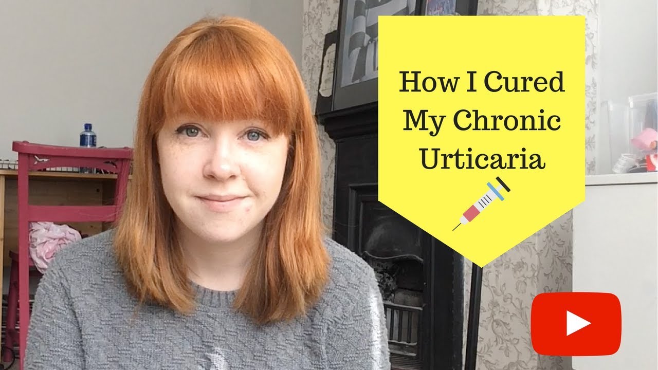 How I Cured My Chronic Urticaria YouTube how-i-cured-my-chronic-urticaria-youtube