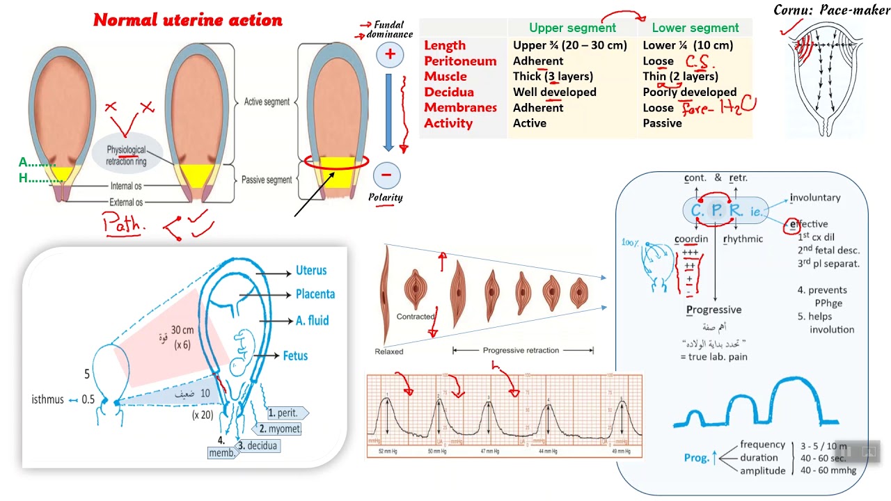 Abnormal uterine action - YouTube