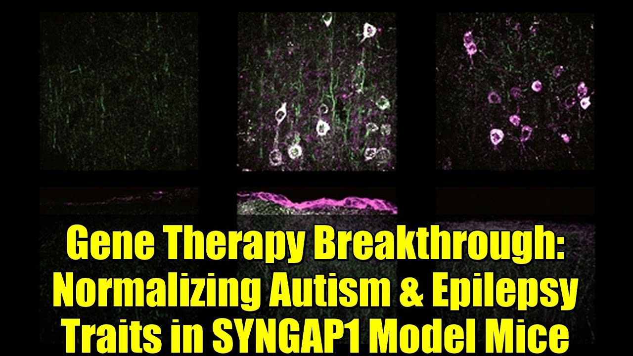 Gene Therapy Breakthrough: Normalizing Autism & Epilepsy Traits in ...
