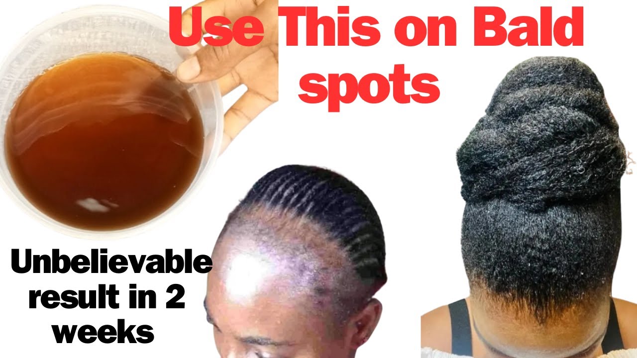 Your Edges May become Too Thick to Handle in JUST 2 WEEKS Of Use. How ...