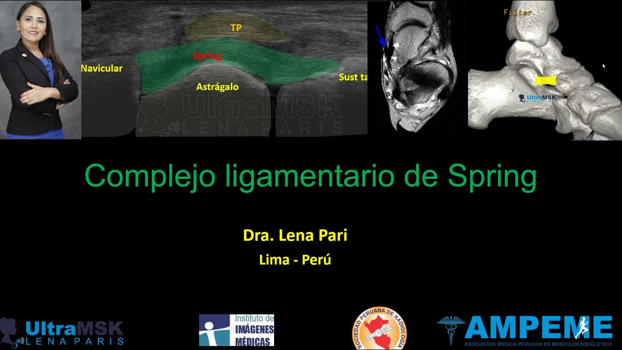 ¡Como evaluar el ligamento de Spring en ultrasonido?. Dra. Lena Pari ...