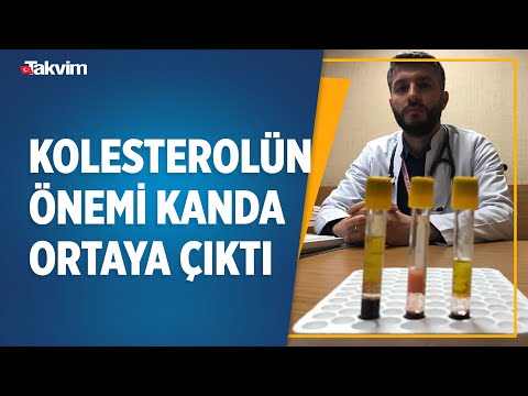 Kolesterolün önemi kanda ortaya çıktı: Düşükte kan berrak, yüksekte bulanık ve katı çıktı