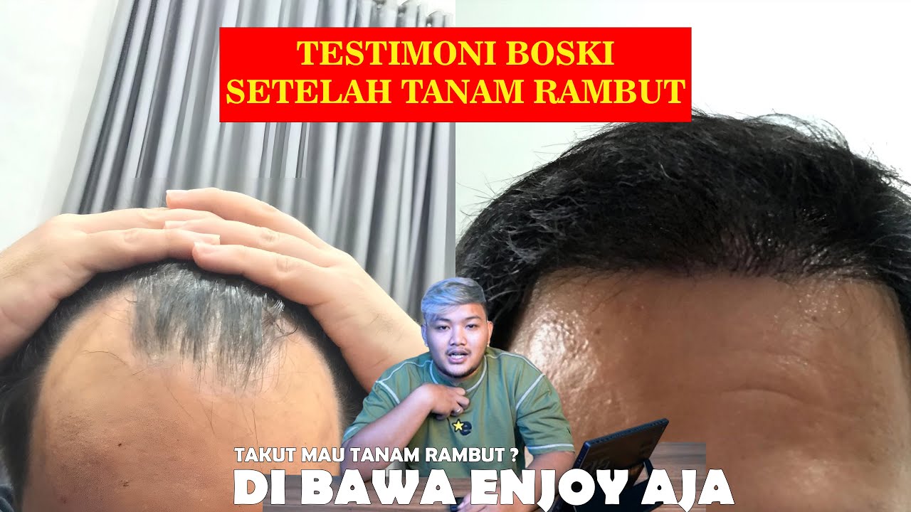 BEFORE AFTER TANAM RAMBUT 42 jt | gas !?? - YouTube