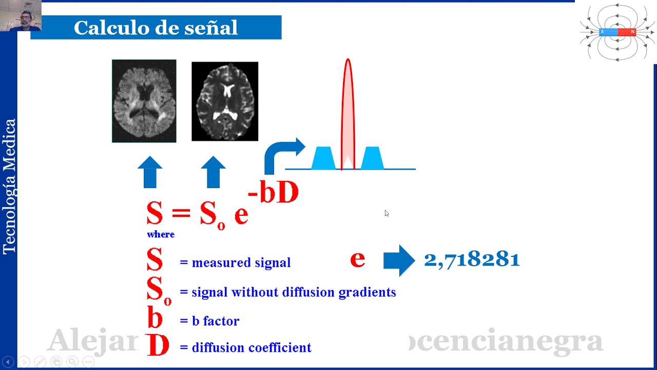 07- Difusión por RMI: Principios básicos de la técnica DWI - YouTube