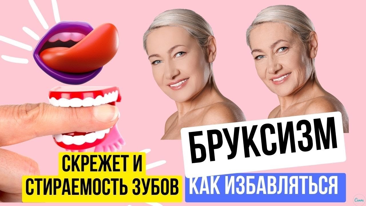 Зубы в Опасности! Как Предотвратить Бруксизм, Скрежет и Стрираемость ...