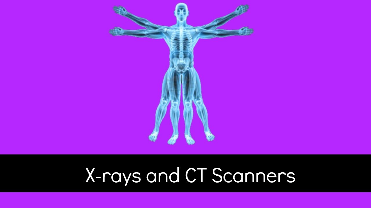 X-rays and CT Scanners - How Do They Work and What are the Problems ...