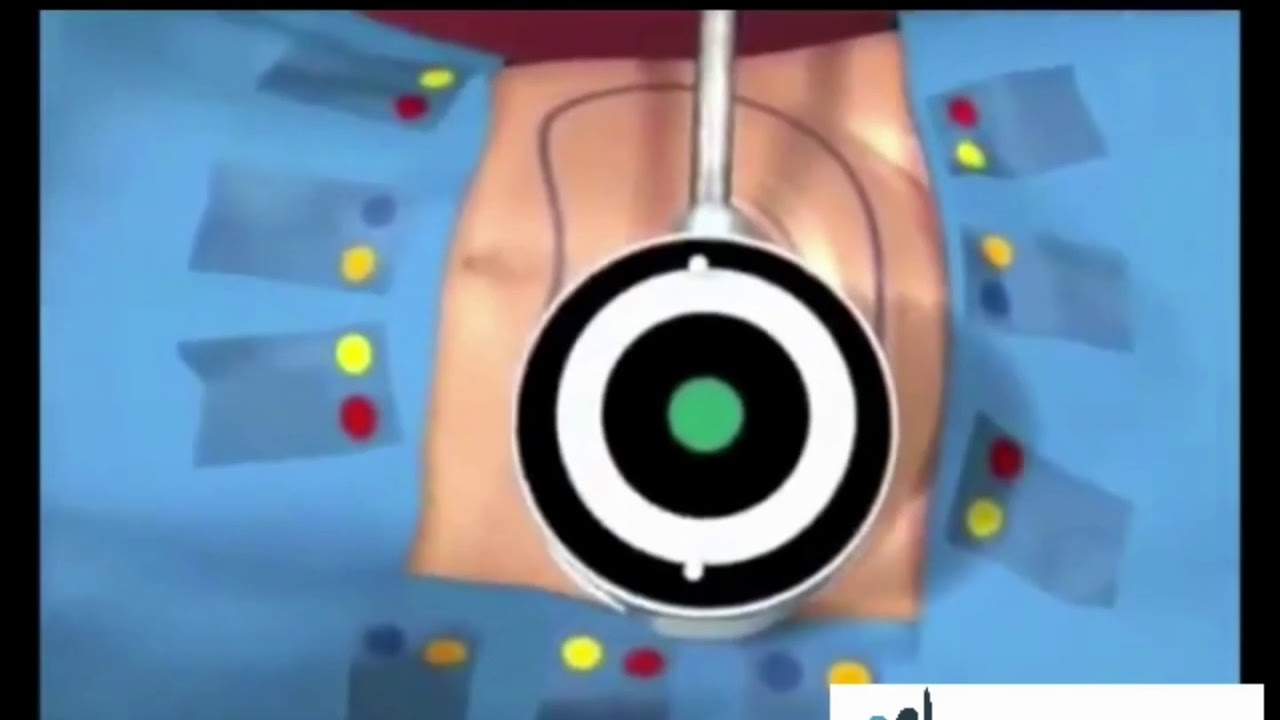 SKIN-DEX - YouTube