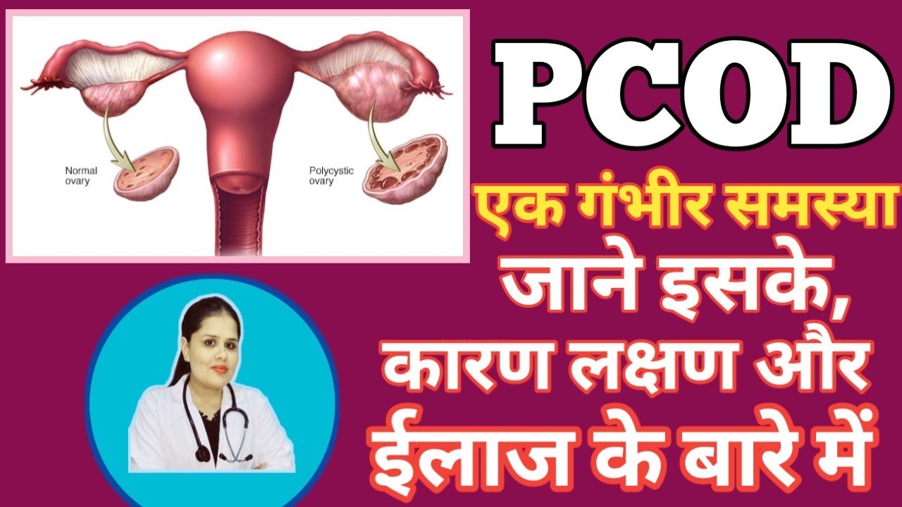 PCOD क्या होता है? बिलकुल आसान शब्दों में समझें || PCOD Symptoms ...