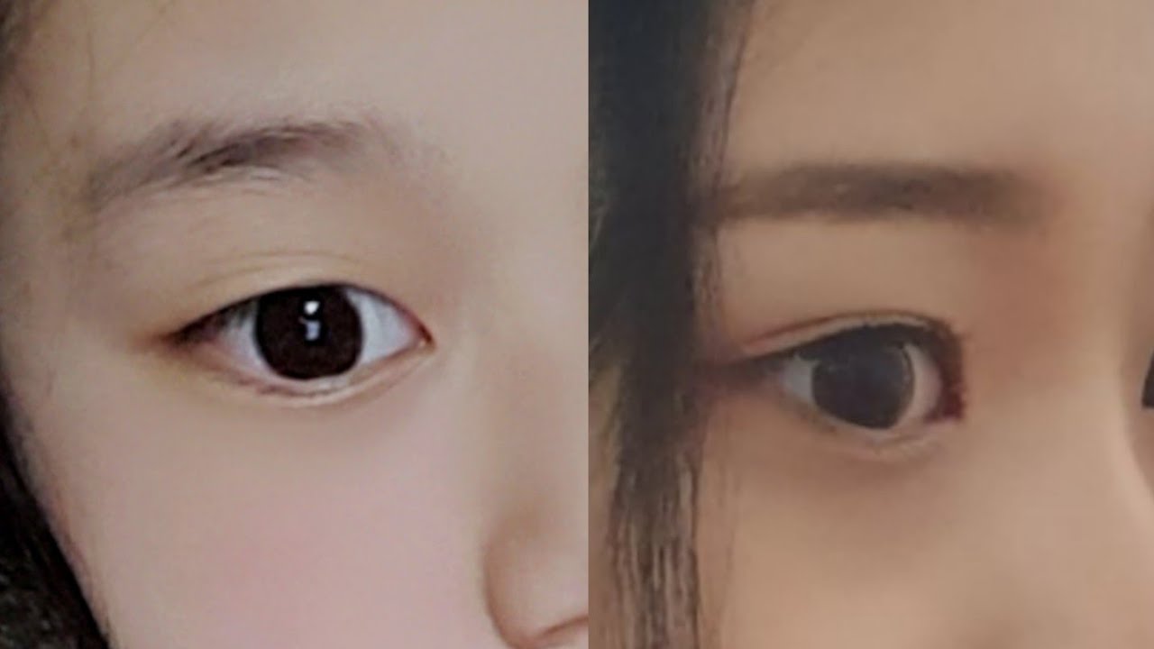 수술없이 쌍커풀생기는법 쌍액하는법 천원으로 쌍커풀만들기 수술없이 쌍커풀 생기는법 눈커지는법 눈살처지지않고
