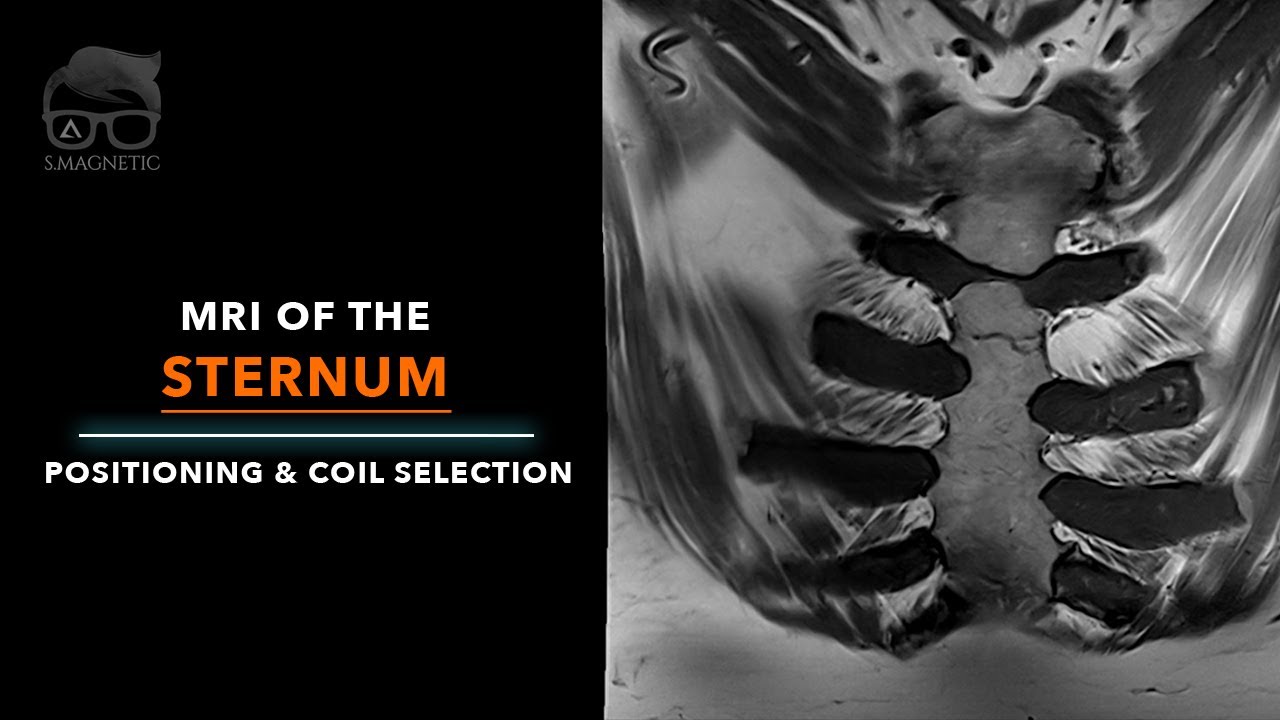 MRI OF THE STERNUM | POSITIONING & COIL SELECTION - YouTube