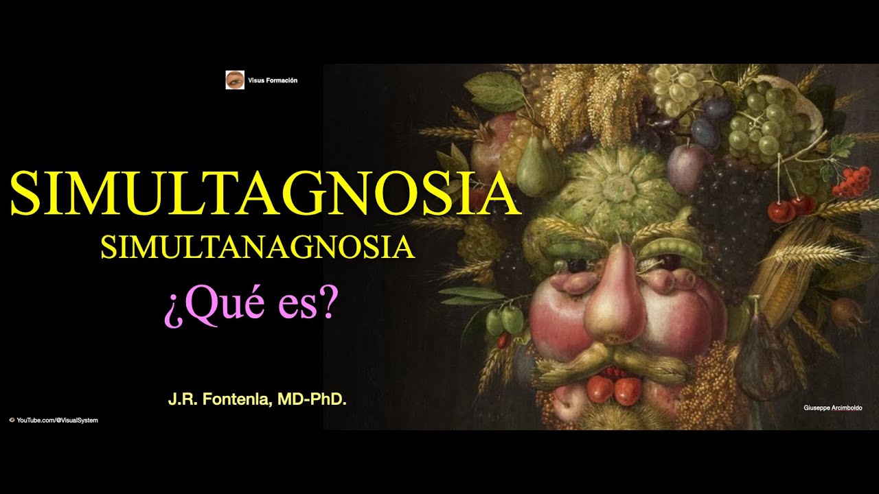 Simultagnosia. Agnosia Visual. - YouTube