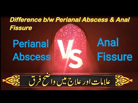 Difference between Perianal Abscess & Anal Fissure | Surgeon Dr Imtiaz ...