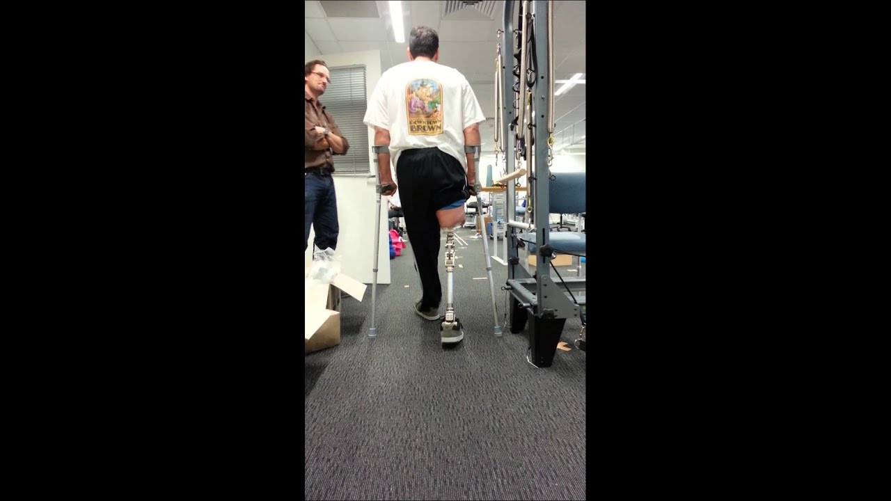 Gimp Man walking on an Osseointegrated Amputee Implant - YouTube