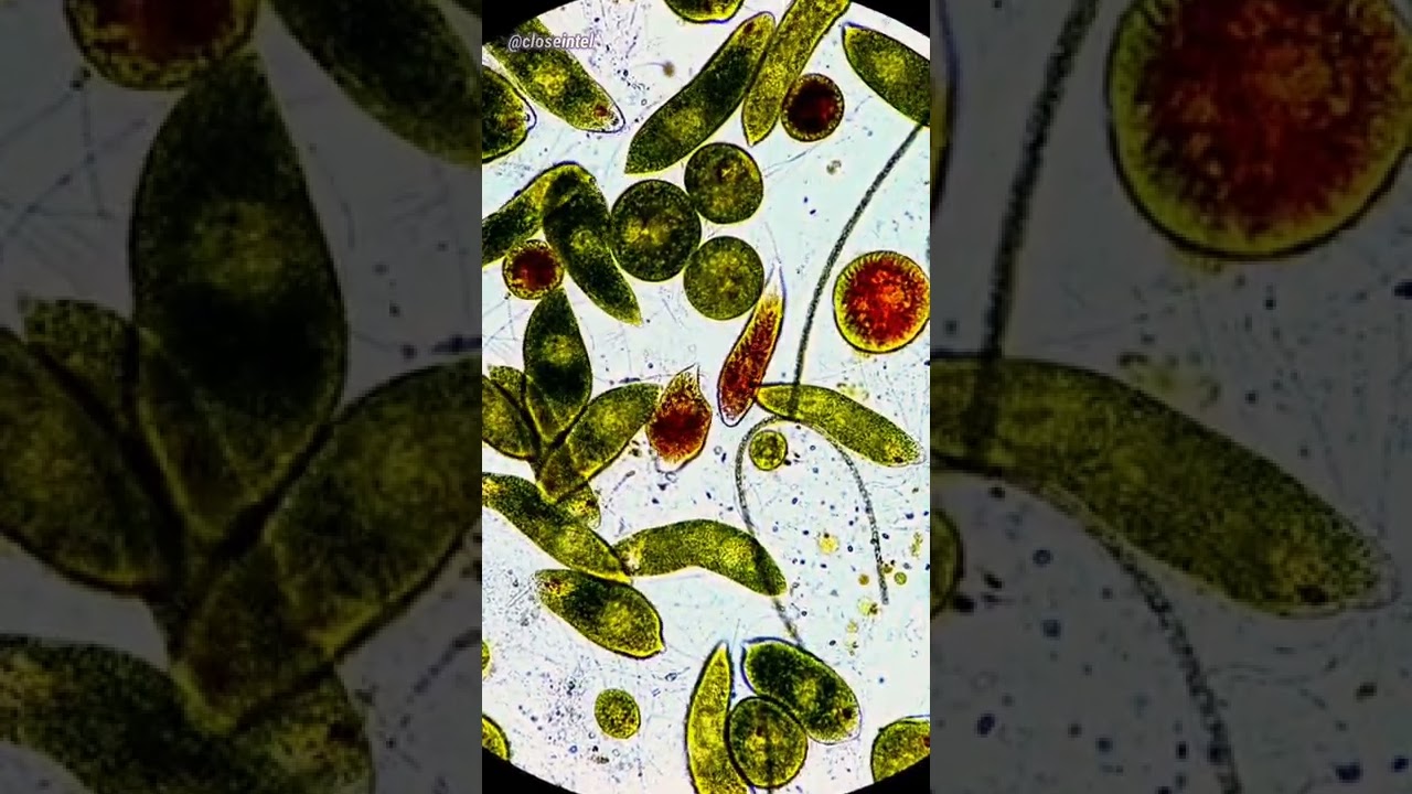 Euglena Under Microscope 400x