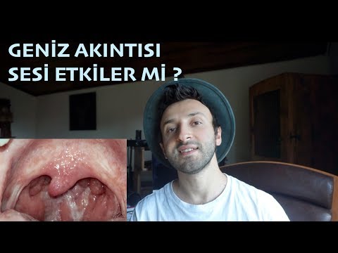 Geniz Akıntısı Sesi Etkiler mi