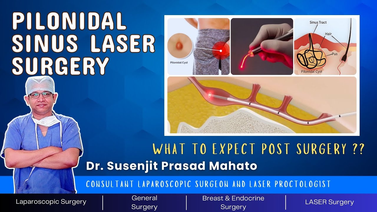 Pilonidal Sinus LASER Surgery: what to expect post surgery ?? - YouTube