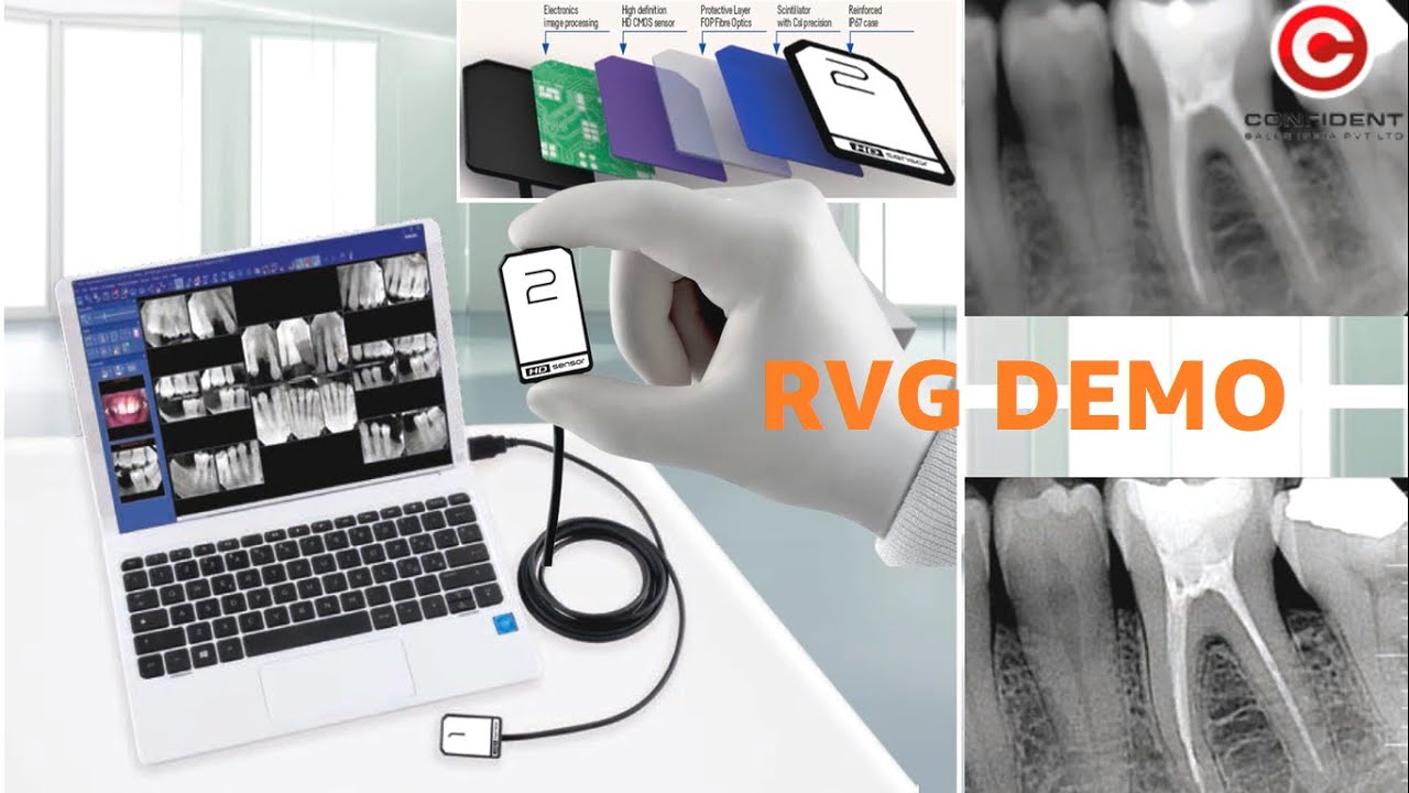 Castellini RVG User Software Demo | How to use | #dentalrvg #rvg # ...