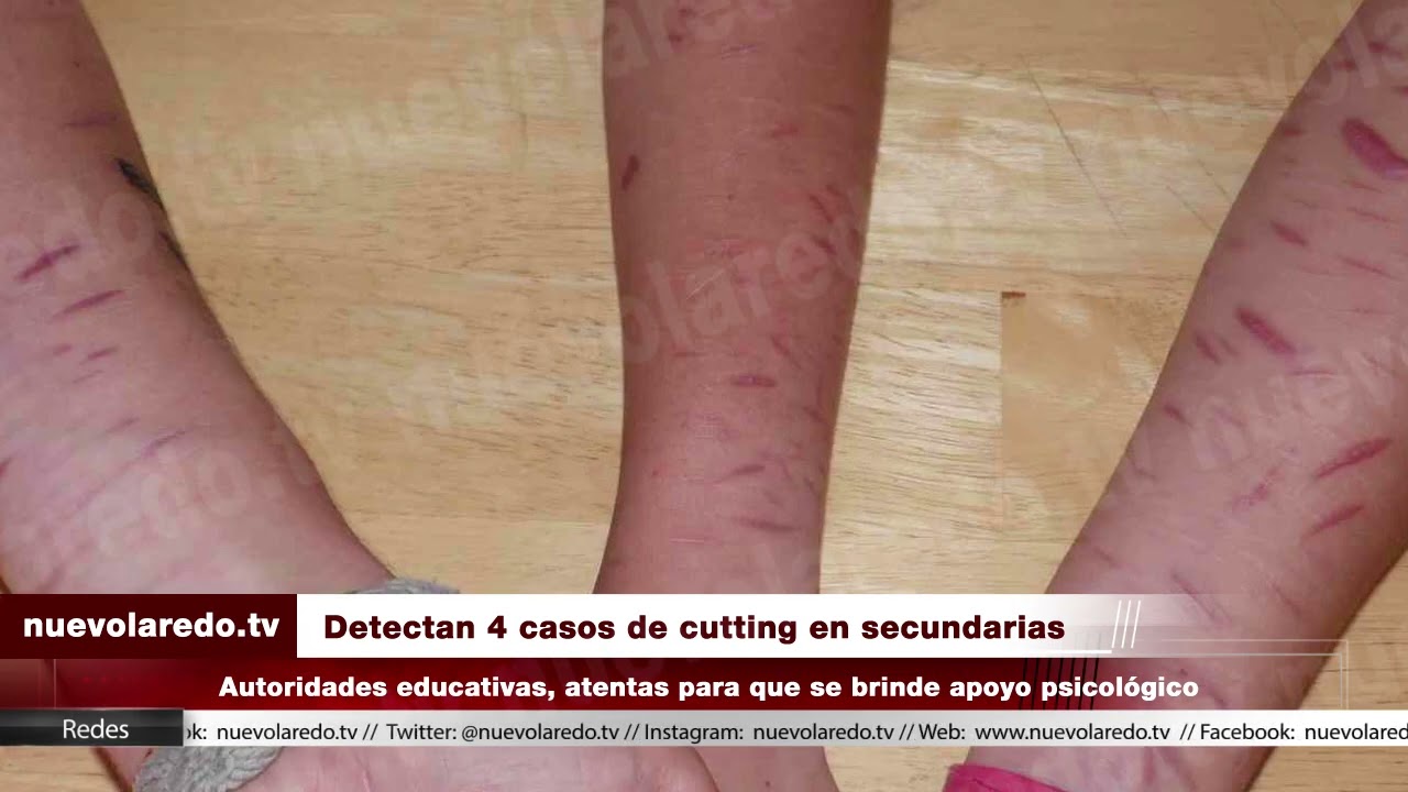Detectan 4 casos de cutting en secundarias - YouTube