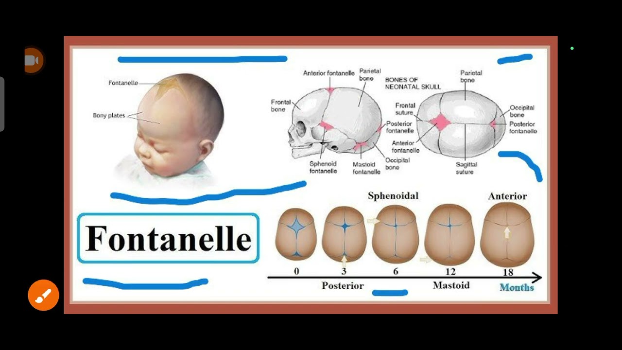 FONTANELLES || fetal skull fontanelles anatomy - YouTube