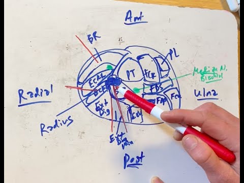 Forearm Extensor Muscles_Dry Needling - YouTube
