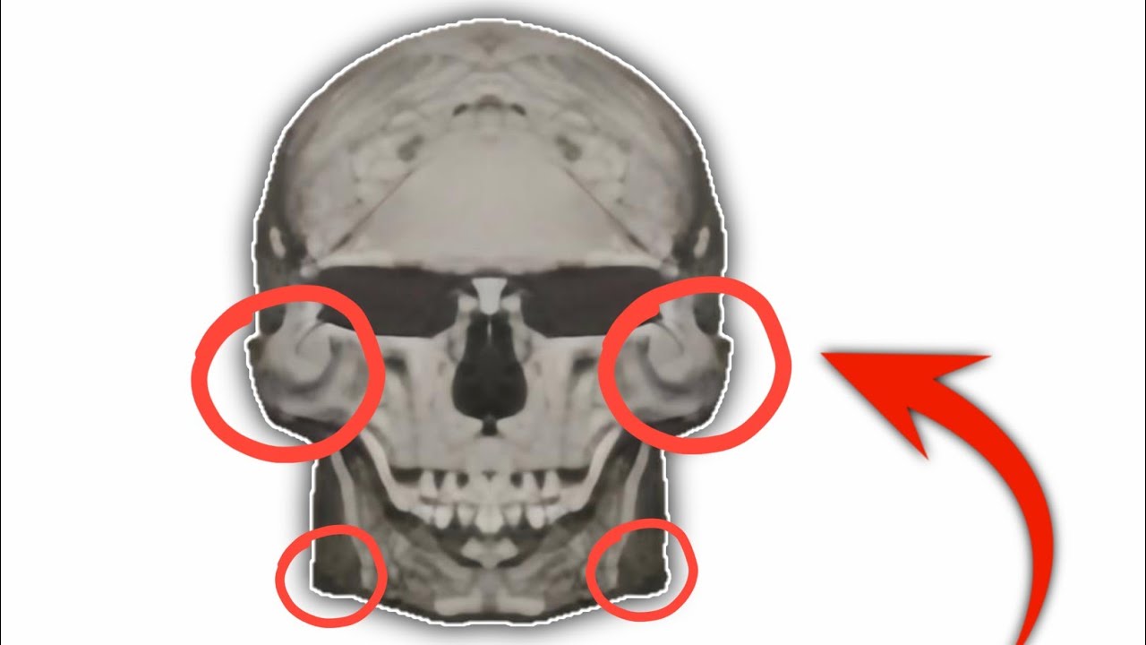 This Habits Increases Bone Mass & Facial Structure - YouTube