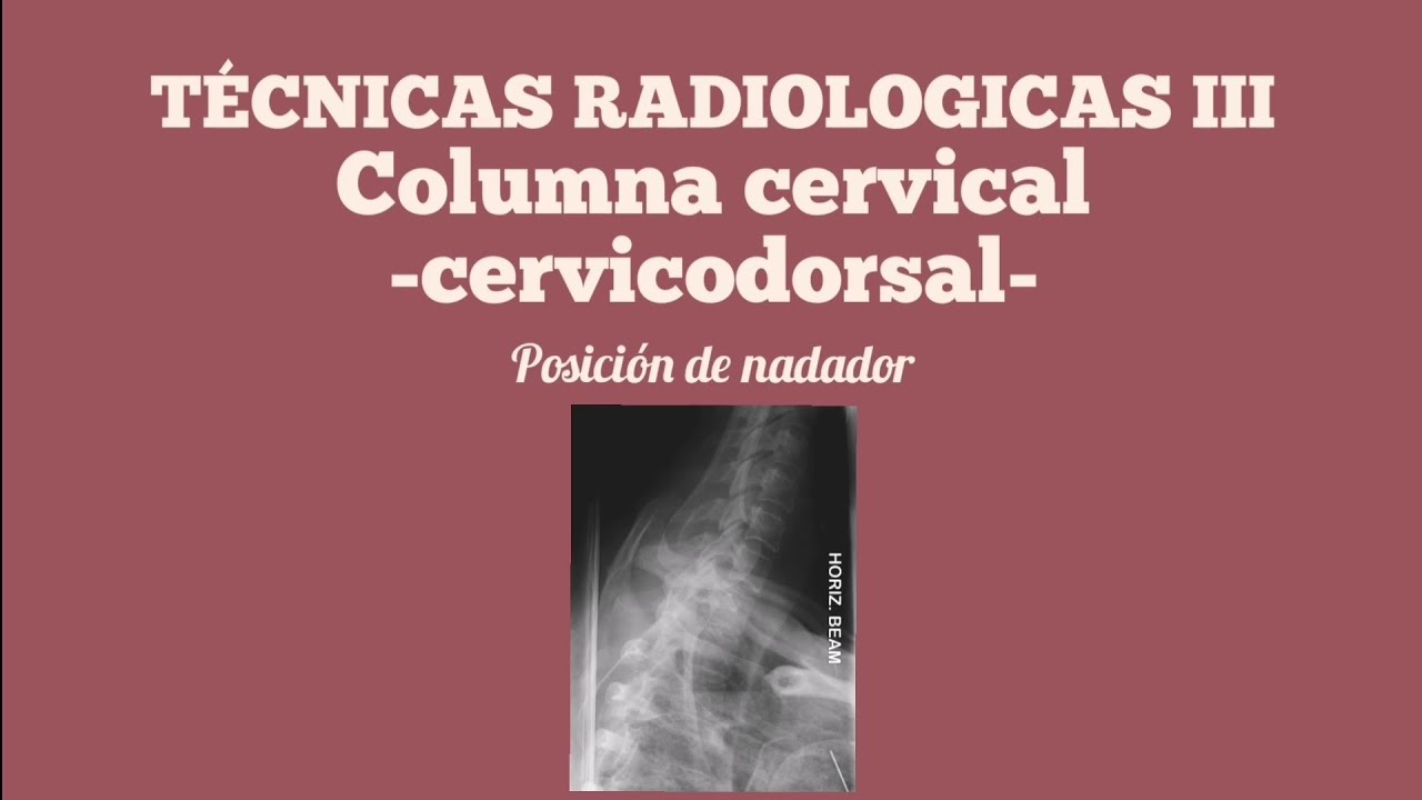 Proyección en posición de nadador para columna cervical baja - YouTube