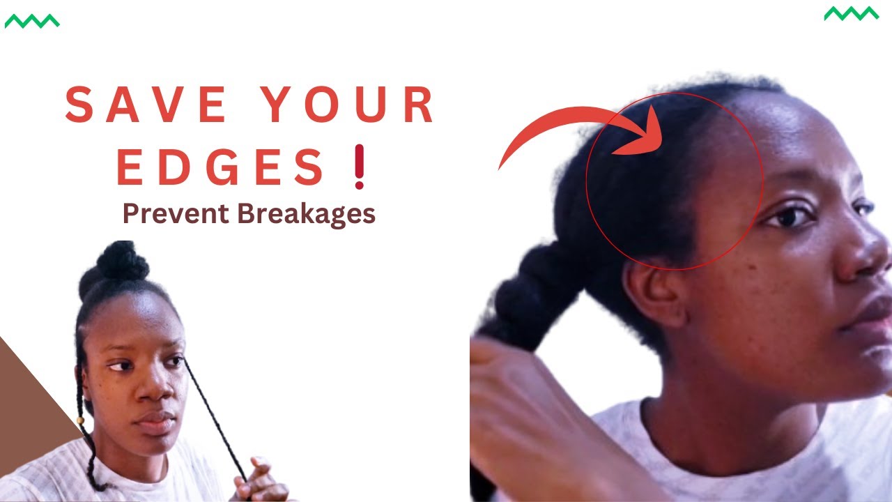 PROTECT Your Edges with These Hairstyles! || Save Your Edges || Prevent ...