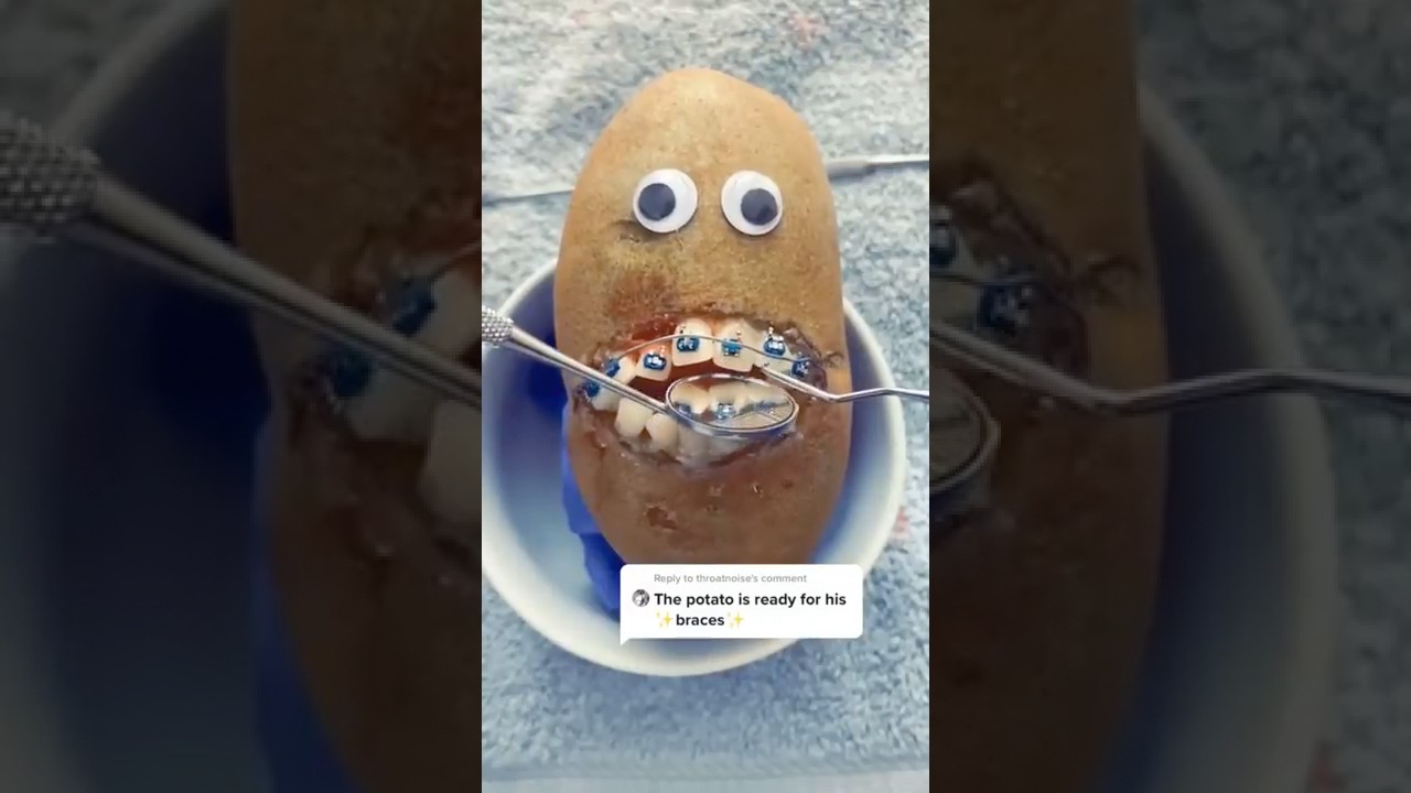 Fruit Surgery - Braces on a potato! 🥔 🦷 Discount Dentist Ep 6 #Shorts ...