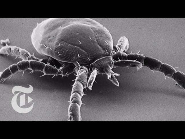 Deer Tick Under Microscope GLA POV: Microbiome Analysis Of Ixodes