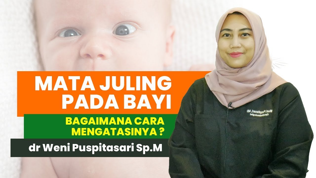 CARA MENGATASI MATA JULING PADA BAYI - VIO Optical Clinic - YouTube
