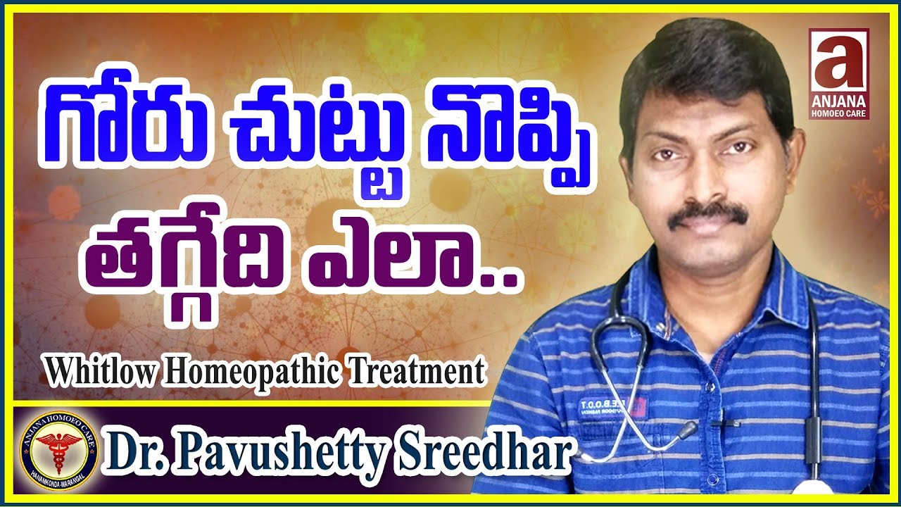 Whitlow Homeopathic Treatment l గోరు చుట్టు నొప్పి తగ్గేది ఎలా.. l Dr ...